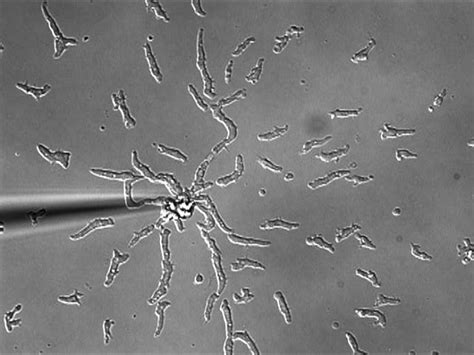 Dictyostelium Under Microscope