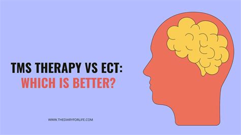 TMS Therapy Vs ECT Which Is Better ThediaryforLife