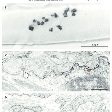 Congenital Myasthenic Syndrome Due To Rapsyn Defi Ciency Rapsyn Download Scientific Diagram