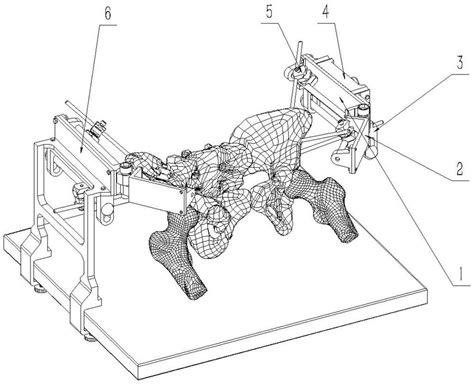Clamping Instrument Of Pelvic Fracture Reduction Robot Eureka Patsnap