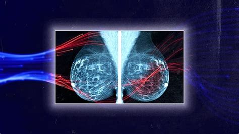 Breast Cancer Detection And Classification Using Deep Learning