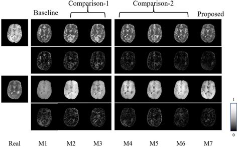 Qualitative Comparison Of The Cross Sequence Brain T1 T2 Image