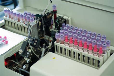 Automated Manufacturing Test Systems For Medical Diagnostic Equipment