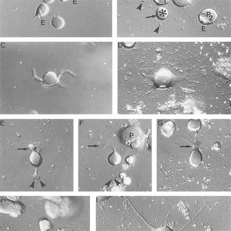 Ultrastructural Features Of A Synaptic Varicosity Contact The Synaptic