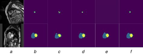 Comparison Of Ce Loss With Our Prior‐induced Loss A Cardiac Image B