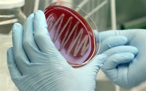 Autoritatile Sanitare Franceze In Alerta In Urma Unei Cresteri Neobisnuite A Infectiilor Cu