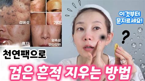 팩하기전 이것으로 얼굴을 먼저 문지르면 기미 검버섯 흑자 주근깨 오타모반 얼굴에 모든 지저분한 흔적이 더 빨리 사라집니다 Youtube