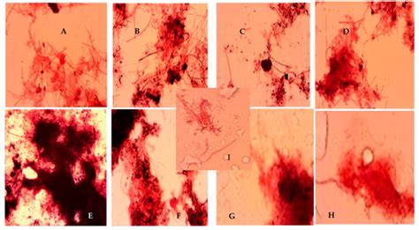 Production Application And Efficacy Of Biodefoamers From Bacillus Aeromonas Klebsiella