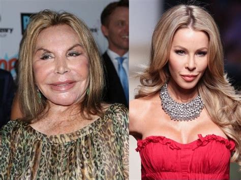 Real Before After Plastic Surgery Inspiring Your Life