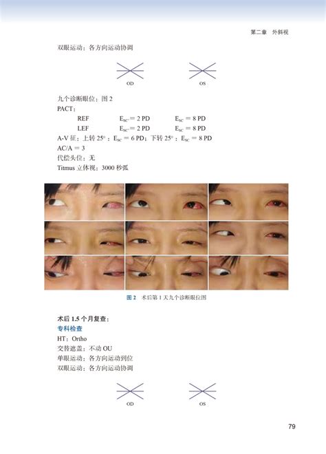 新书上架：新版 斜视经典病例解析 张伟 主编 好医术文章 好医术 赋能医生守护生命