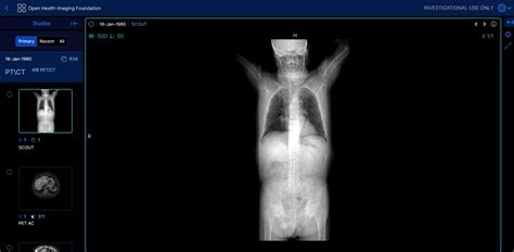 measuring tools are not showing in the viewer v 3 · issue 3373 · ohif
