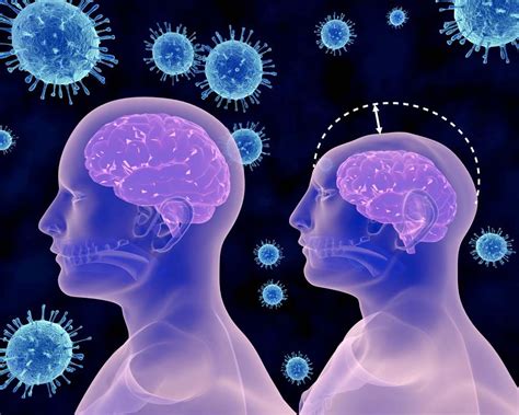 Microcephaly Causes Symptoms And Treatment Britannica