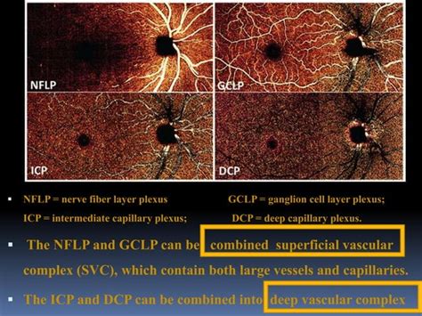 Prognostic Value Of Multiple Differential Diagnosis Of Onh By Oct Angio