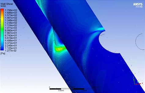 Figure 18 From Computational Fluid Dynamics Modeling Of Hemodialysis In