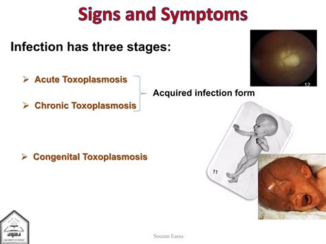 Intestinal Coccidia Toxoplasma Gondii Pdf