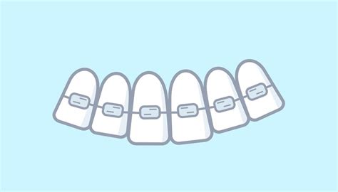 Premium Vector Dental Braces Doodle Icon Vector Illustration Of