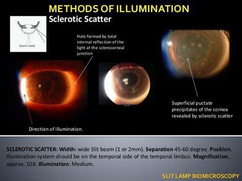 Spectralis Oct Normal Anatomy Systematic Interpretation Artofit