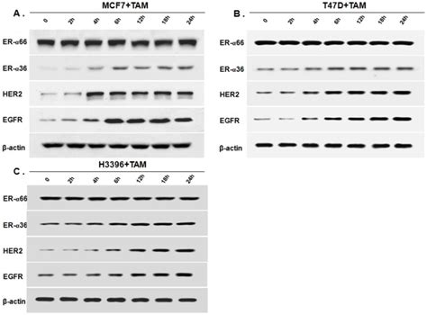 Western Blot Analysis Of The Expression Levels Of Er α66 Er α36 Her2