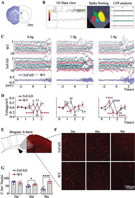Attenuated Complete Freund Adjuvant Induced Local Field Potential