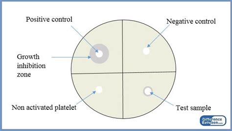 Difference Between Positive And Negative Control