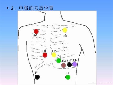 基于ads1298的心电图仪 Csdn博客