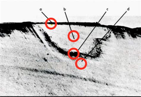 Case 19 Histology Of Caries Flashcards Quizlet