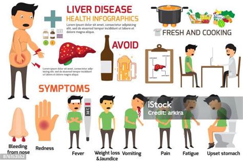 간 질병 벡터 인포 그래픽입니다 기호와 간 질환의 증상입니다 벡터 일러스트 레이 션 간염에 대한 스톡 벡터 아트 및 기타 이미지