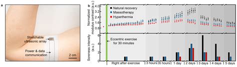 Serial Monitoring Of Deep Tissue Stiffness Using Wearable Ultrasound Patch Research