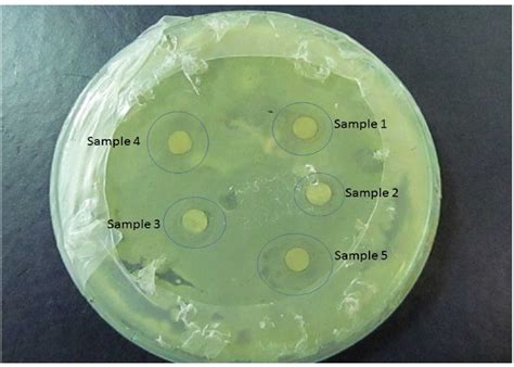 Zno Influence On Thermophysical Characteristics Of Natural Polymer Based Nanofluids
