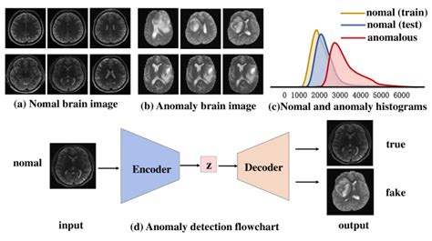 Brain Tumor Anomaly Detection Via Latent Regularized Adversarial Network Deepai