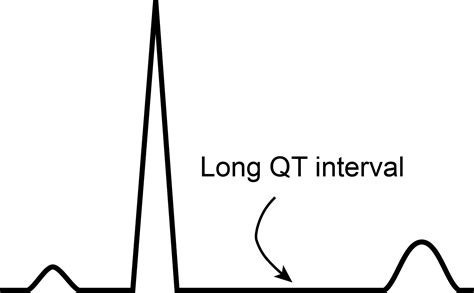 Calcium And Arrhythmias Clinician Revision
