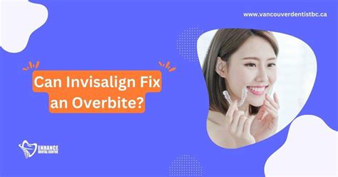 Can Invisalign Fix An Overbite Enhance Dental Care
