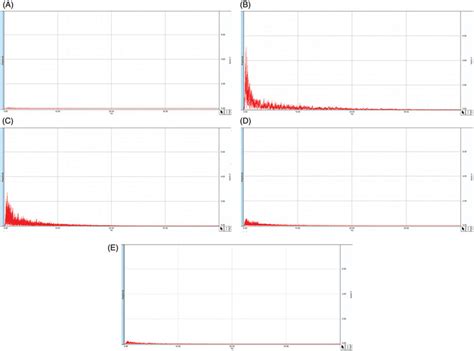 Respective Power Spectrum Analysis Of EEG From Various Experimental Download Scientific Diagram