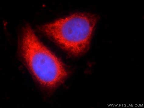 Cnot9 Antibody 22503 1 Ap Proteintech