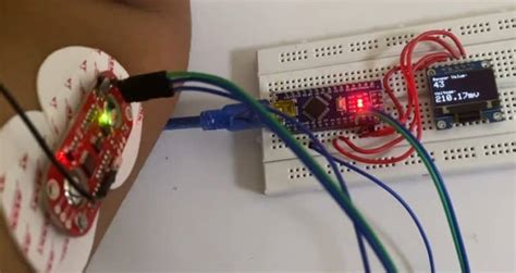 Electromyography With MyoWare Muscle Sensor Arduino