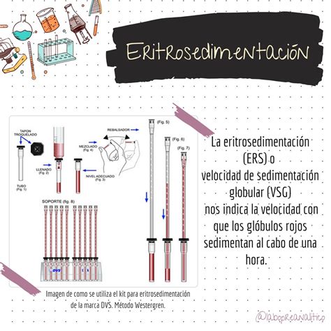 Terapia Melodioso Reemplazar Tubo De Westergren Desigualdad Cantante Deportes