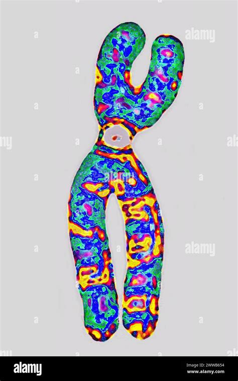 Human Chromosome 23 Pairs Of Chromosomes 46 Chromosomes 22 Pairs