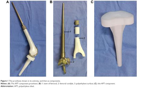 Limb Salvage Treatment Of En Block Resected Distal Femoral Tumors With