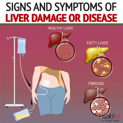 Liver Pain Symptoms Location