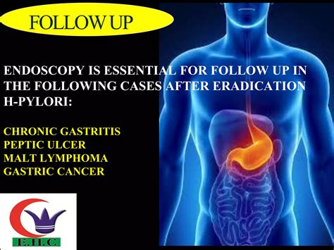 Role Of Endoscopy In Management Of H Pylori Disorders Ppt