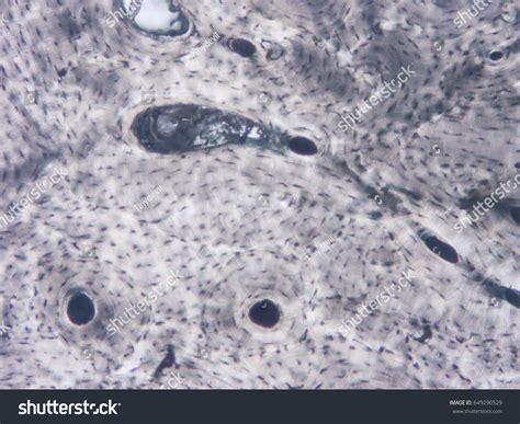 Histology Human Compact Bone Tissue Show Stock Photo Shutterstock
