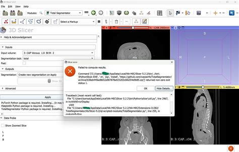 unable to use total segmentator in slicer 5 2 2 support 3d slicer