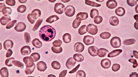 The Gene Therapy Revolution Risks Stalling If We Dont Talk About Drug