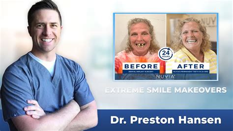Extreme Smile Makeovers Dr Preston Hansen Nuvia Chief Clinical