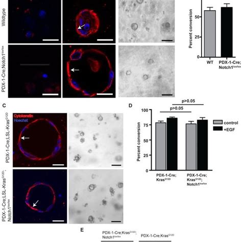 A Pancreatic Explants From Wildtype And Pdx 1 Crenotch1loxlox Mice