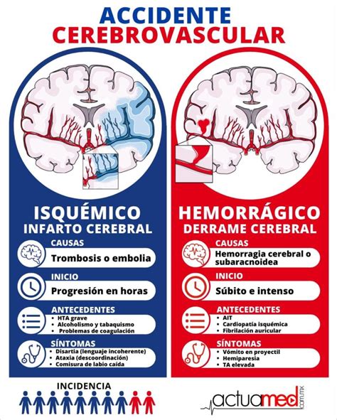 Saber Identificar Un Accidente Cerebrovascular Puede Salvar La Vida De