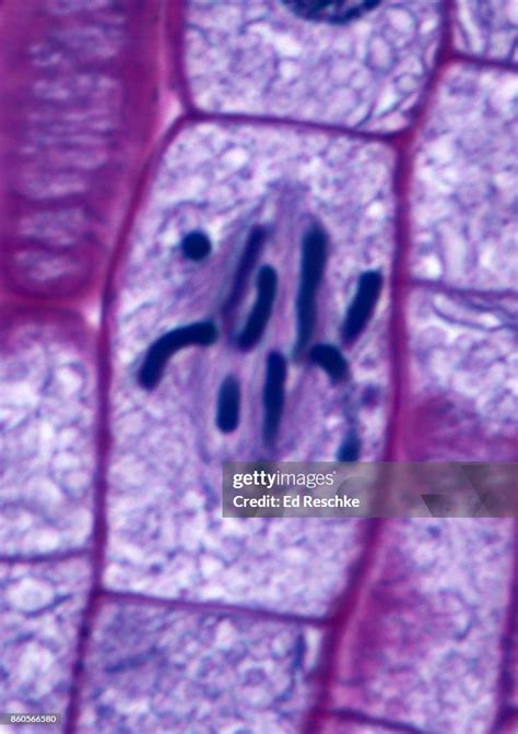 Metaphase Plant Cell
