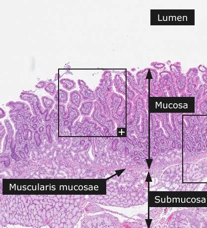 Intestine Duodenum Magnification Duodenum An Overview