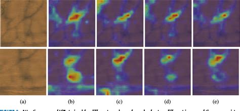 Figure 1 From Explainable Vision Transformers For Vein Biometric Recognition Semantic Scholar
