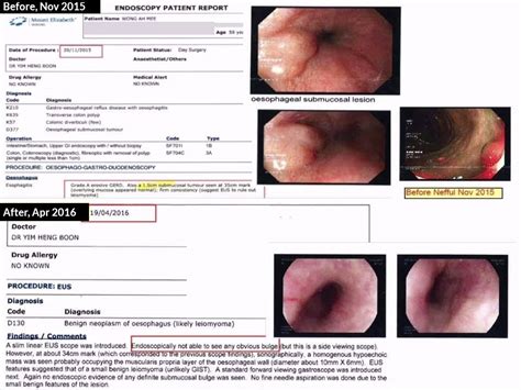 Hepatitis Testimonials Negative Ion Clotheshepatitis Testimonials